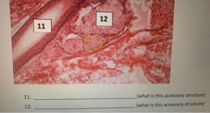 Solved 12 11 11. (what is this accessory structure) (what is | Chegg.com