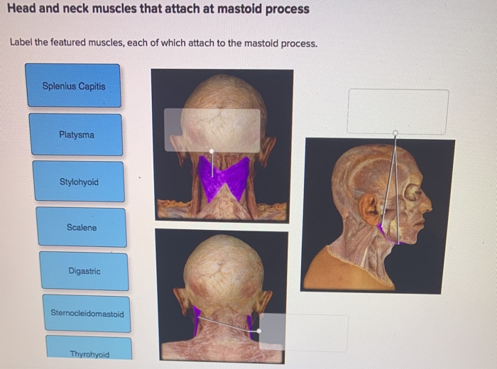 Solved Head and neck muscles that attach at mastoid process | Chegg.com