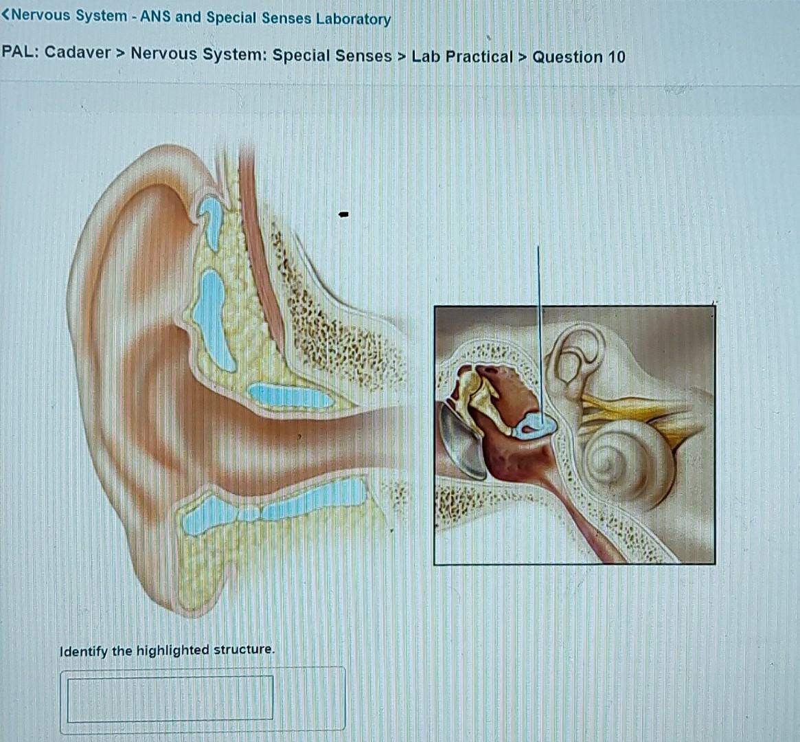 Solved Nervous System: Special Senses > Lab Practical > | Chegg.com