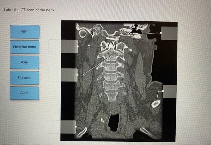 Solved Label the CT scan of the neck. | Chegg.com