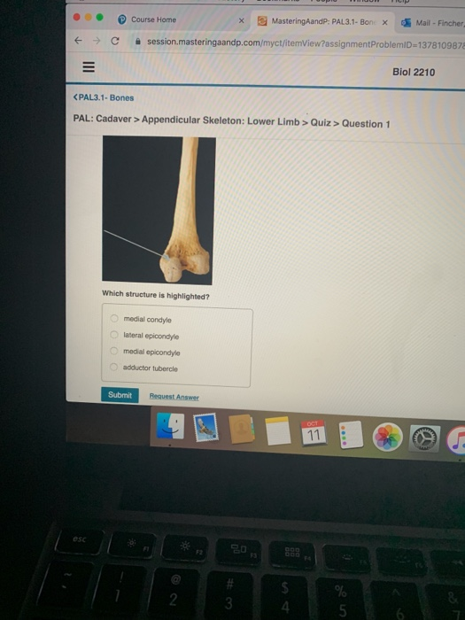 Solved: Mail- Fincher MasteringAandP: PAL3.1- Bon P Course... | Chegg.com