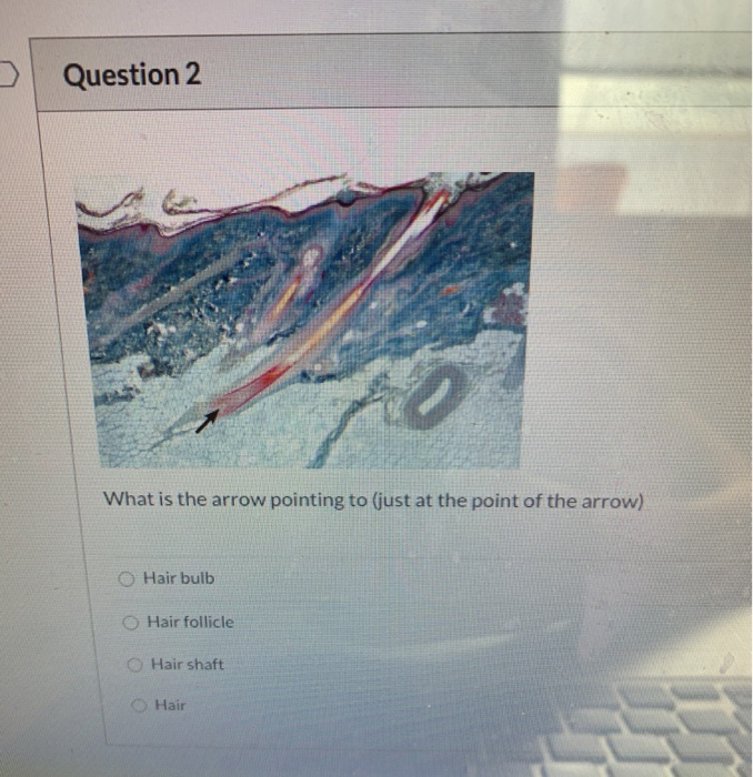 Solved Question 2 mo What is the arrow pointing to (just at | Chegg.com