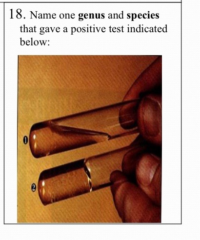 Solved Station 8. 16. What is the selective agent found in | Chegg.com