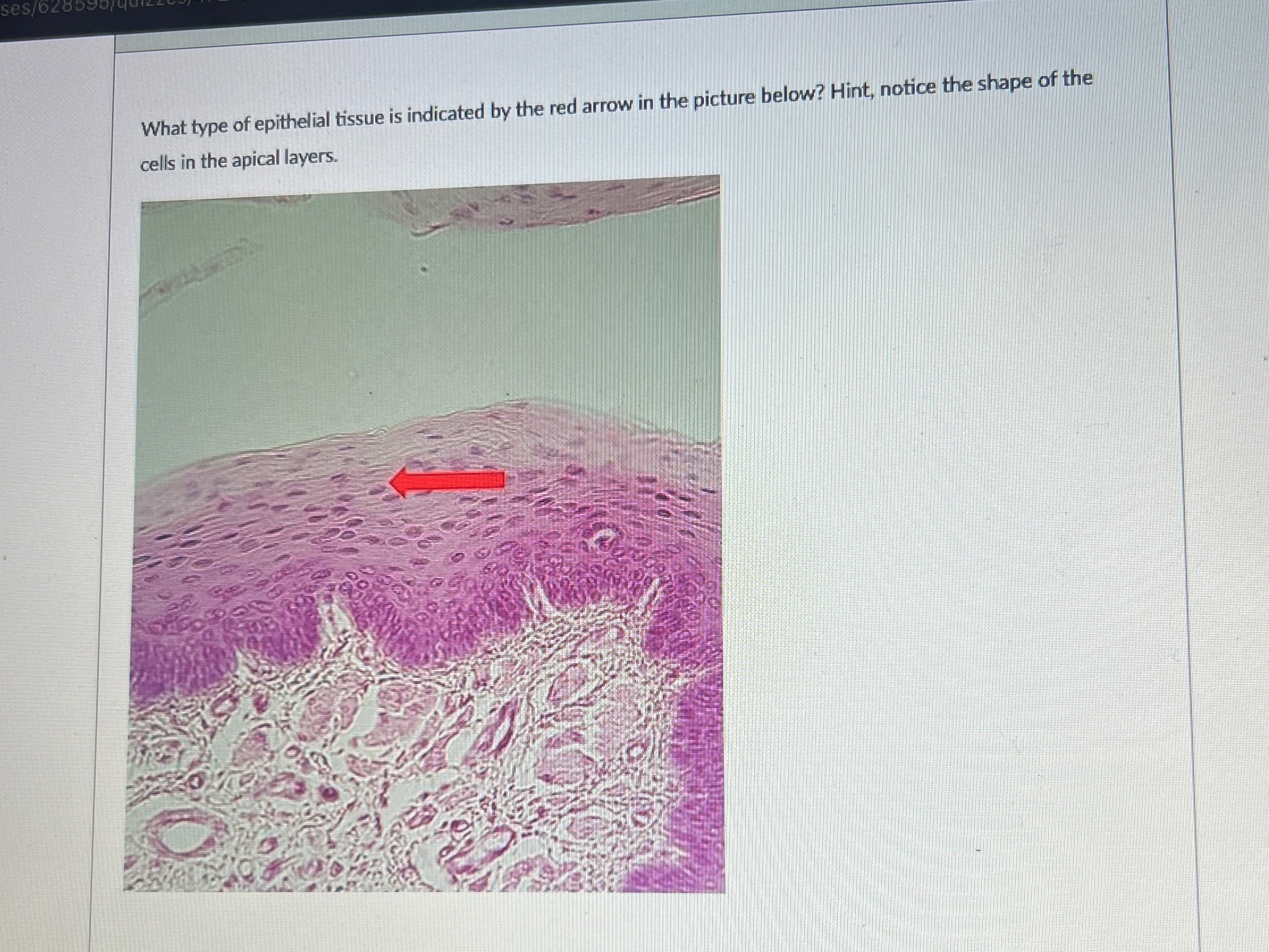 Solved What type of epithelial tissue is indicated by the | Chegg.com