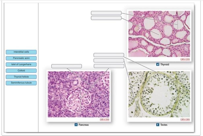 Solved Exercise 33 Review & Practice Sheet: Endocrine System | Chegg.com