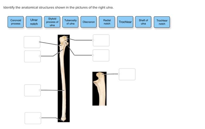 Solved Identify the anatomical structures shown in the | Chegg.com Solved Identify the anatomical structures shown in the | Chegg.com