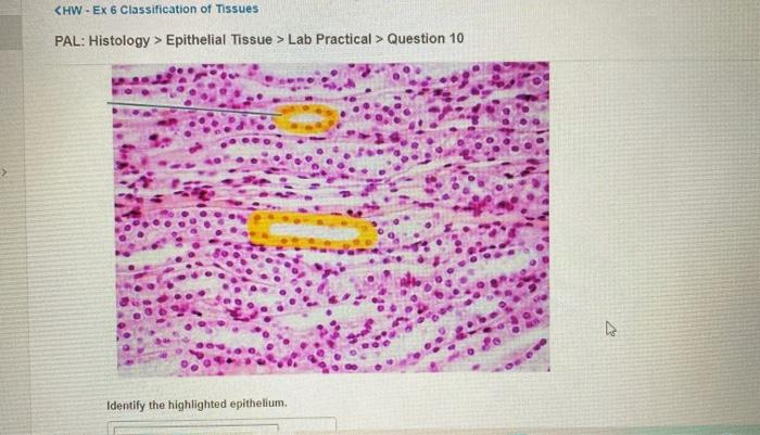 Solved Epithelial Tissue > Lab Practical > Question 10 | Chegg.com