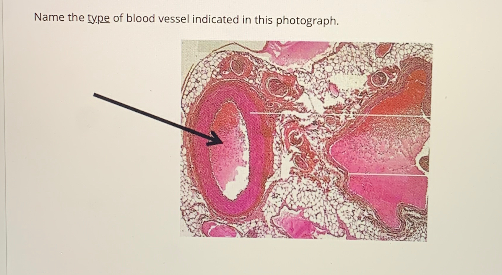 Solved Name the type of blood vessel indicated in this | Chegg.com