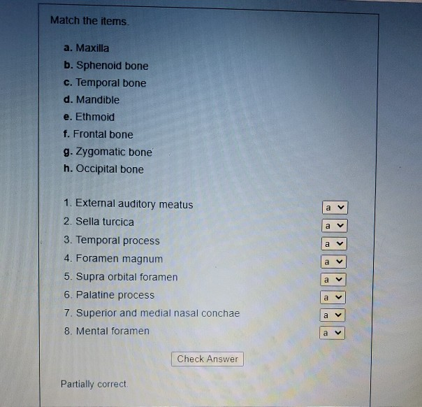 Solved Match the items. a. Maxilla b. Sphenoid bone c. | Chegg.com