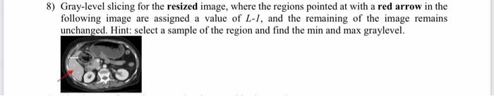8 Gray Level Slicing For The Resized Image Where