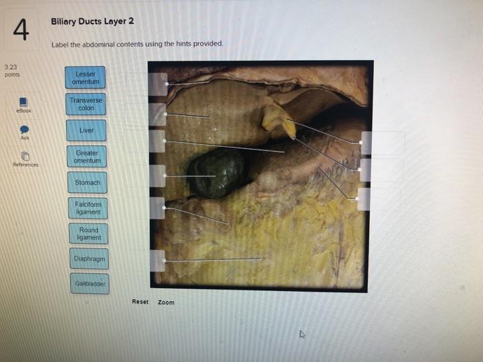 Solved Biliary Ducts Layer 2 4 Label the abdominal contents | Chegg.com
