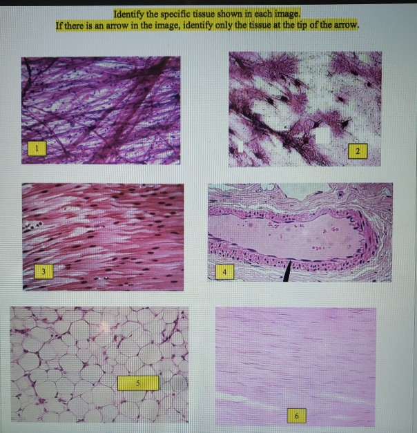 Solved Tissue location matching. Choices are used once or | Chegg.com