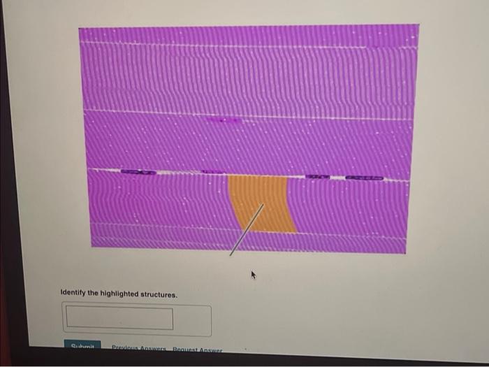 Solved Idenury the highlighted fiber type. Identify the | Chegg.com