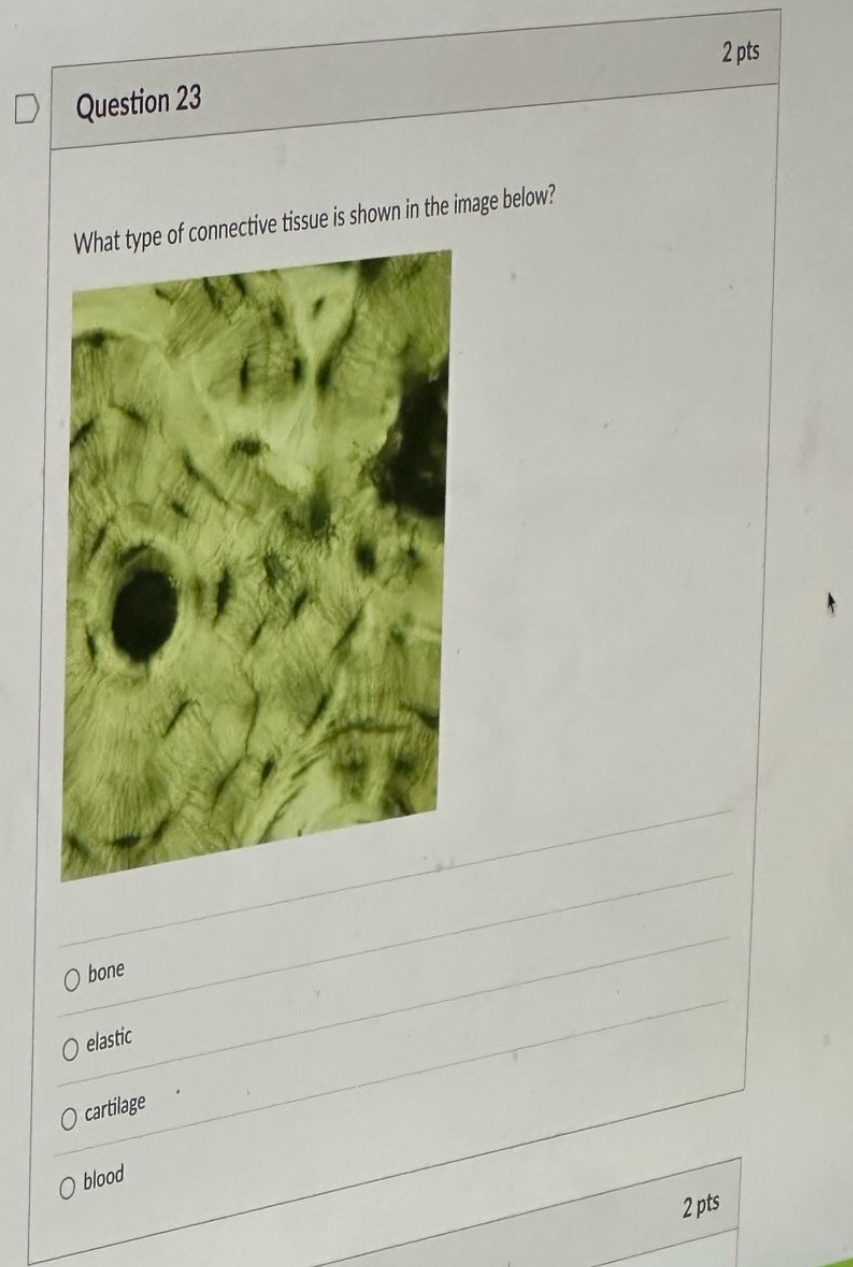 Solved Question 232ptsWhat type of connective tissue is | Chegg.com