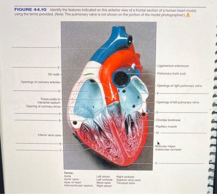 Solved FIGUPE 44.10 Identify the features indicated on this | Chegg.com