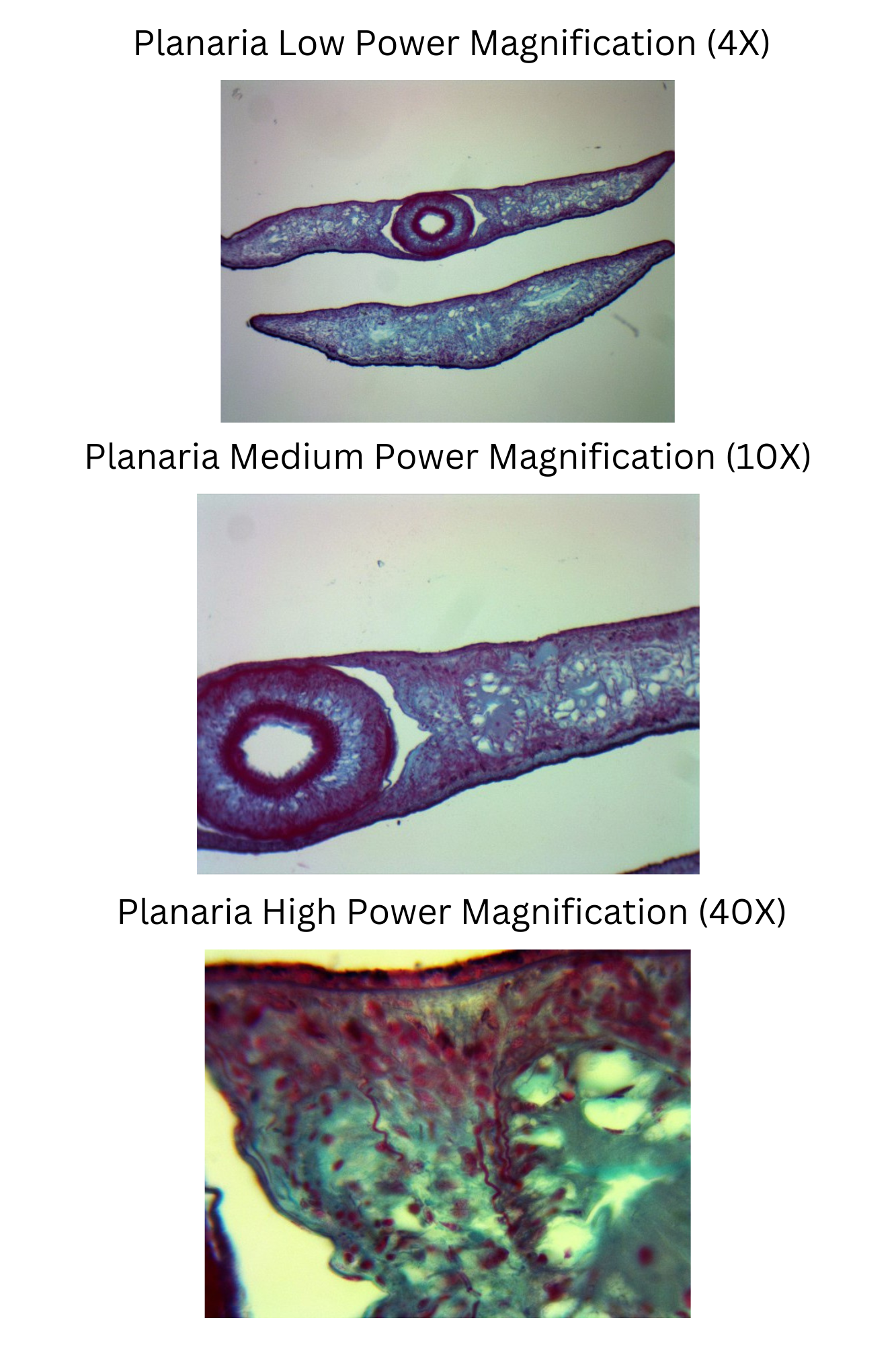 Solved Attached is a Planaria slide under the microscope at | Chegg.com