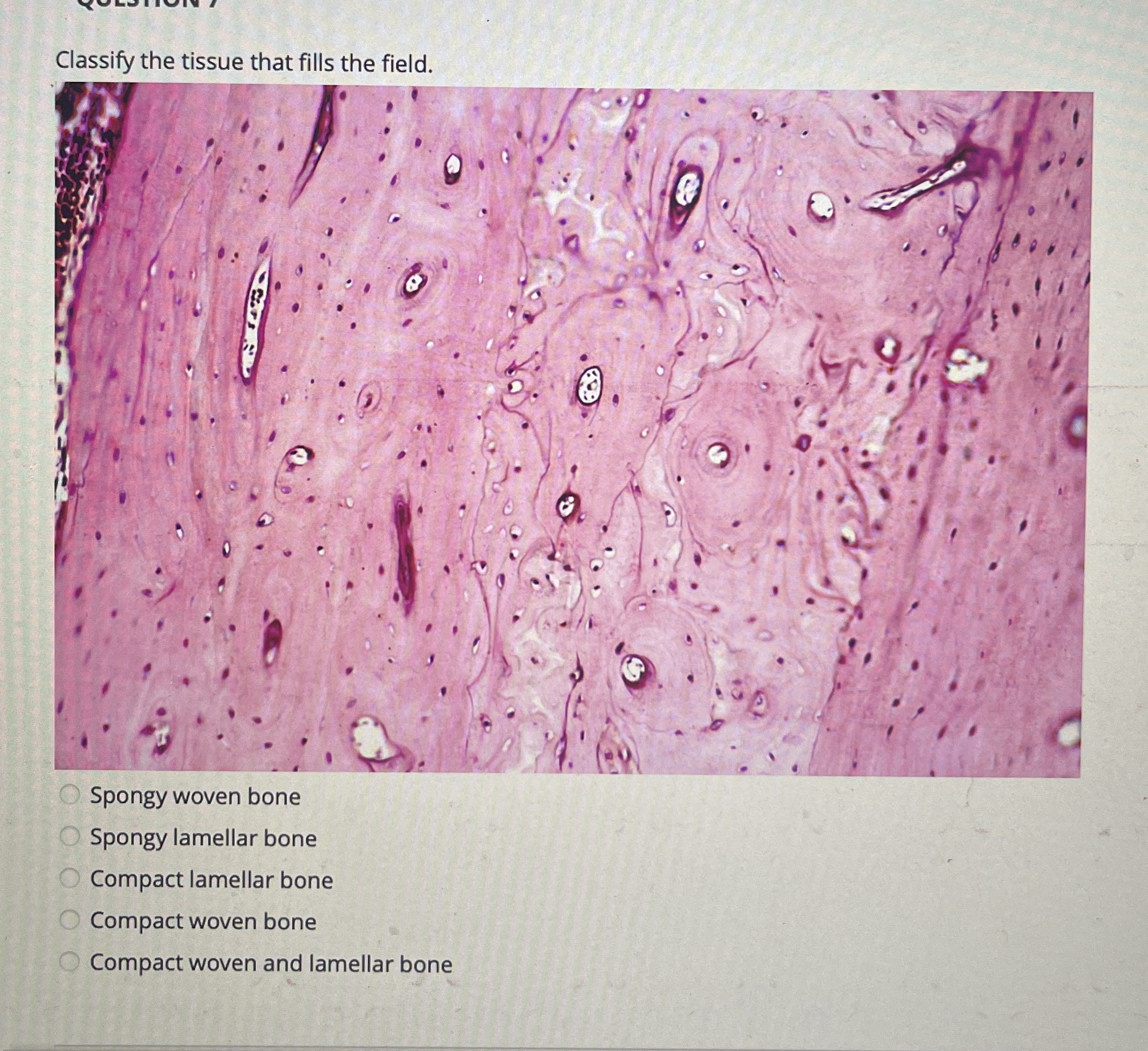 Solved Classify the tissue that fills the field.Spongy woven | Chegg.com