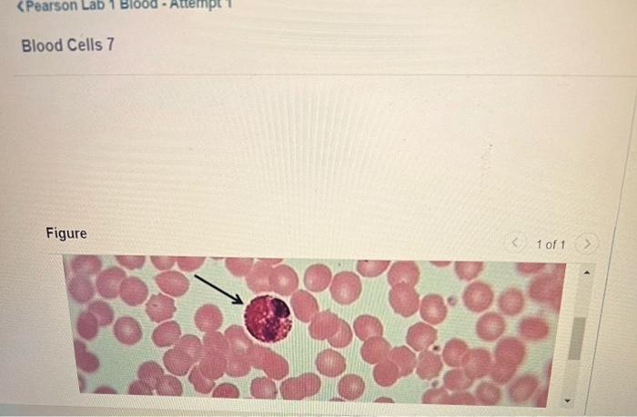 Figure(Figure 1) formed element with a multilobed | Chegg.com
