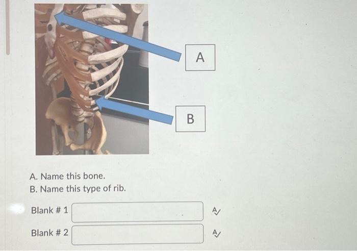 Solved A. Name this bone. B. Name this type of rib. Blank \# | Chegg.com