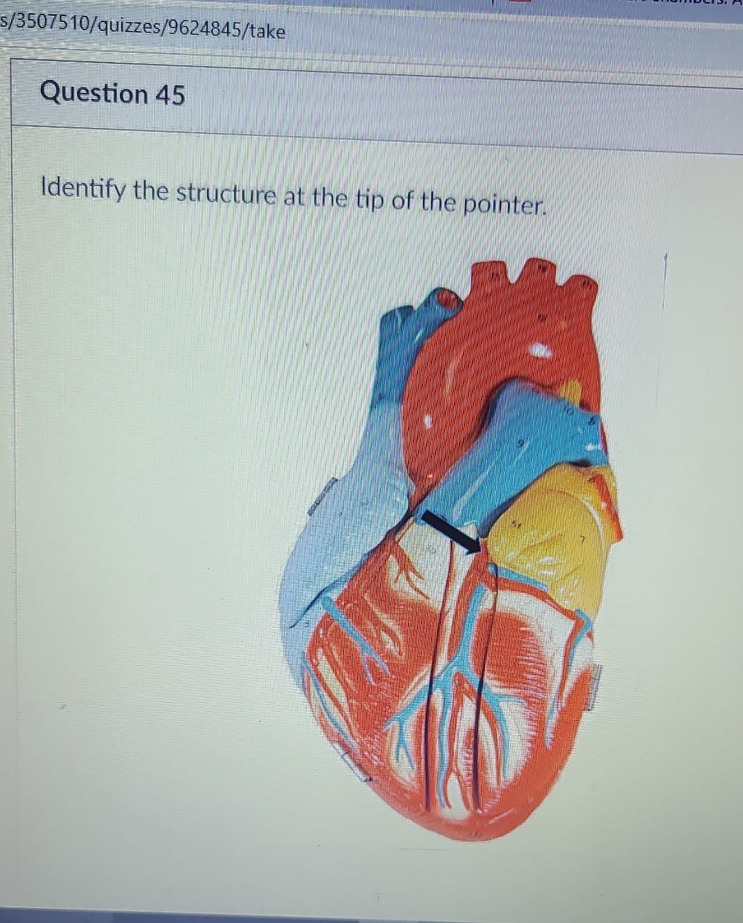 Solved Identify the vessel at the tip of the | Chegg.com