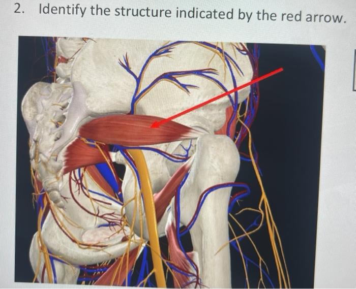 Solved 2. Identify the structure indicated by the red | Chegg.com