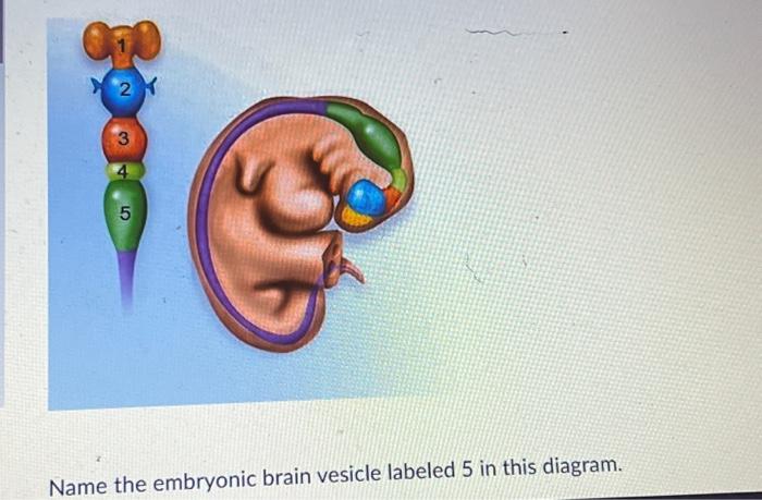 Solved Name the embryonic brain vesicle labeled 5 in this | Chegg.com