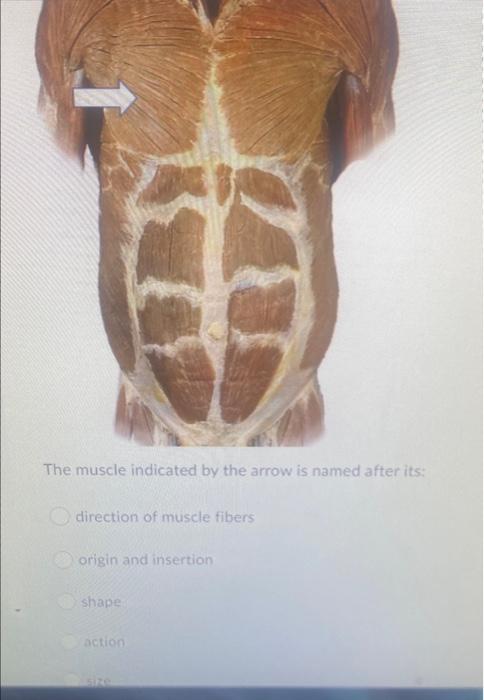 Solved The muscle indicated by the arrow is named after its: | Chegg.com