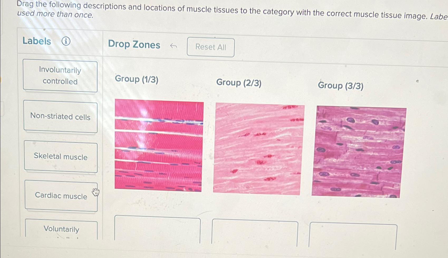 Solved Drag the following descriptions and locations of | Chegg.com