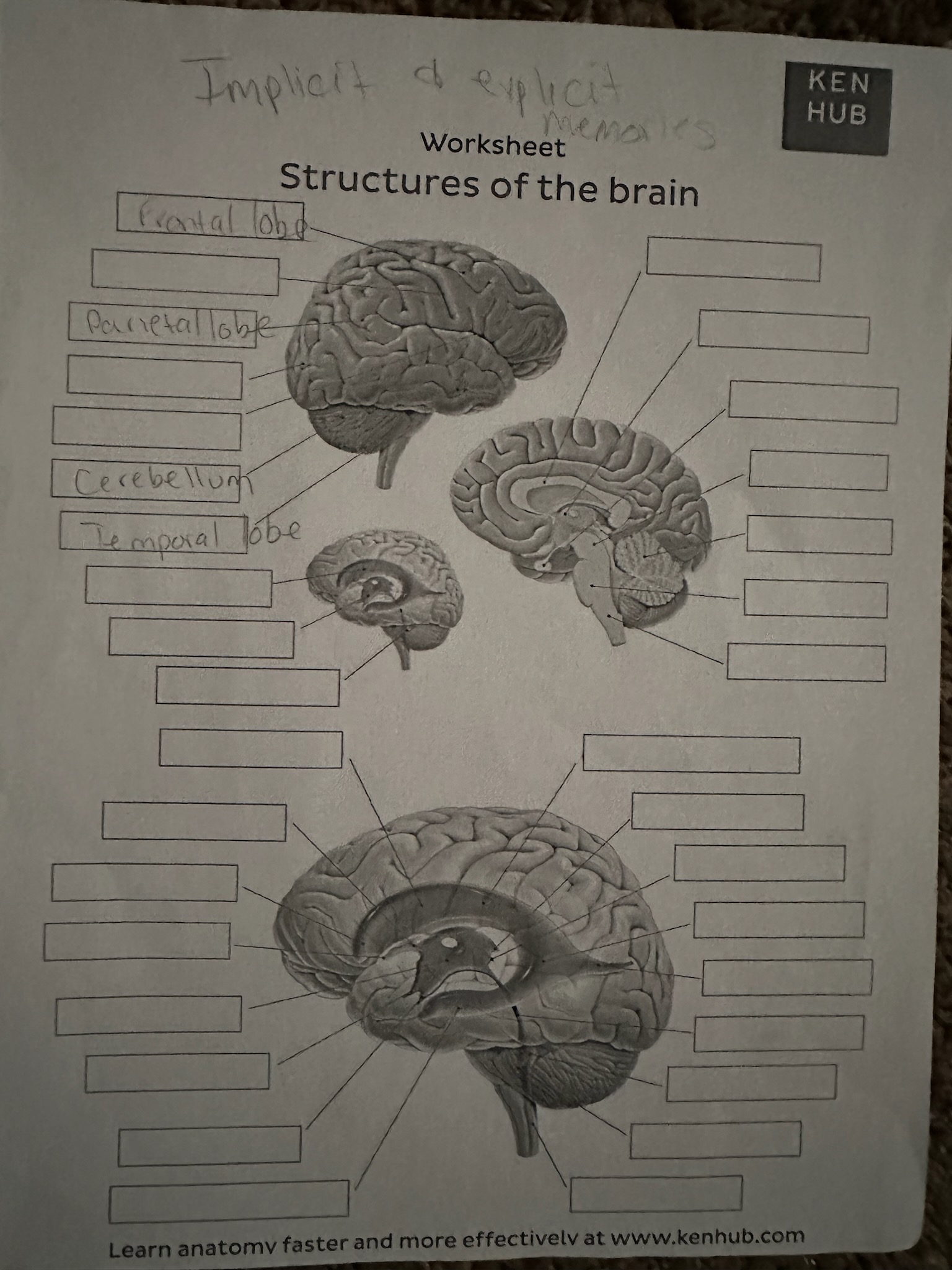 Solved Illustrate on my brain model the lobes of the brain | Chegg.com