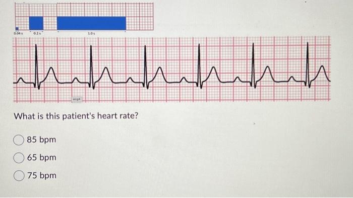 Solved What is this patient's heart rate? 85 bpm 65bpm 75 | Chegg.com