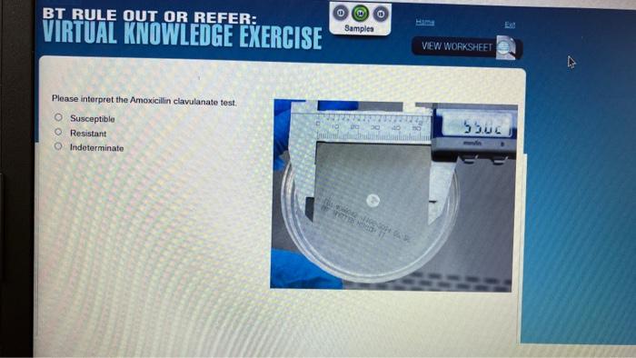 Solved BT RULE OUT OR REFER: VIRTUAL KNOWLEDGE EXERCISE | Chegg.com