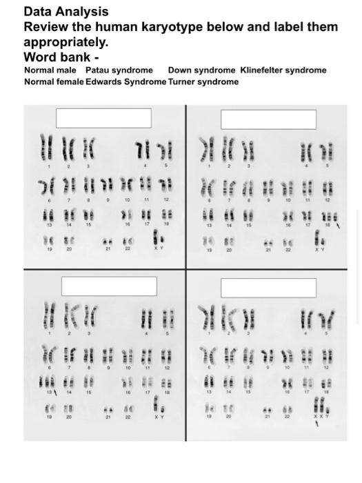 Solved Data Analysis Review the human karyotype below and | Chegg.com