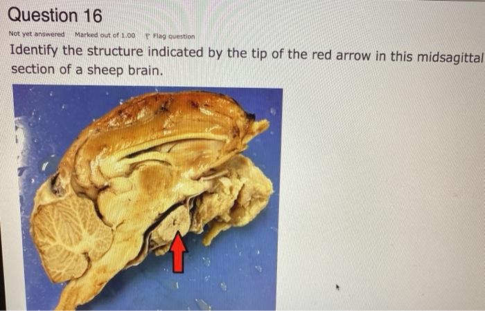 Solved Identify the structure indicated by the tip of the | Chegg.com