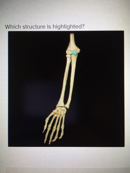 Solved Which structure is highlighted? Multiple Choice O | Chegg.com