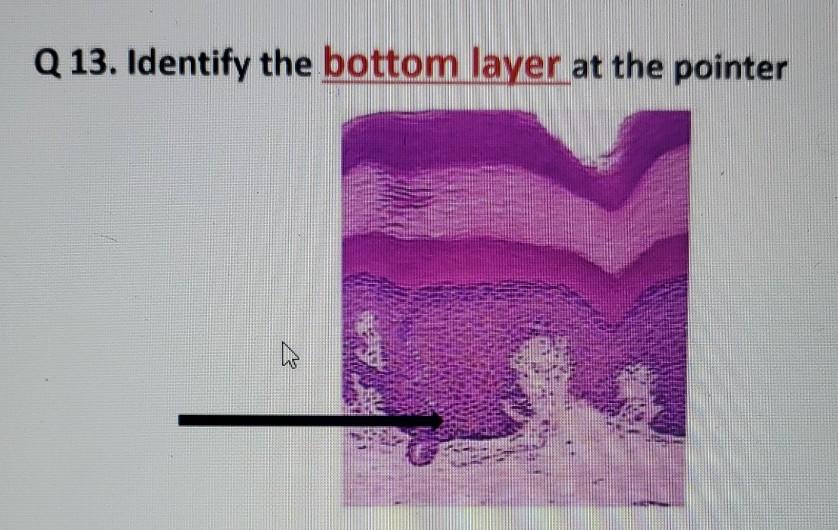 Solved Q 13. Identify the bottom layer at the pointer | Chegg.com