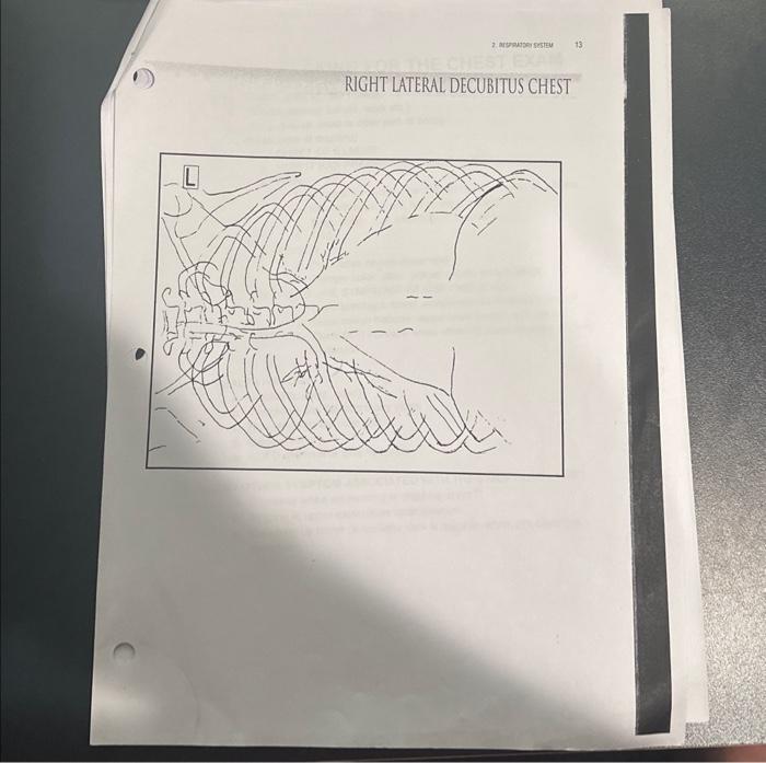 Solved naming the parts of the right lateral decubitus chest | Chegg.com