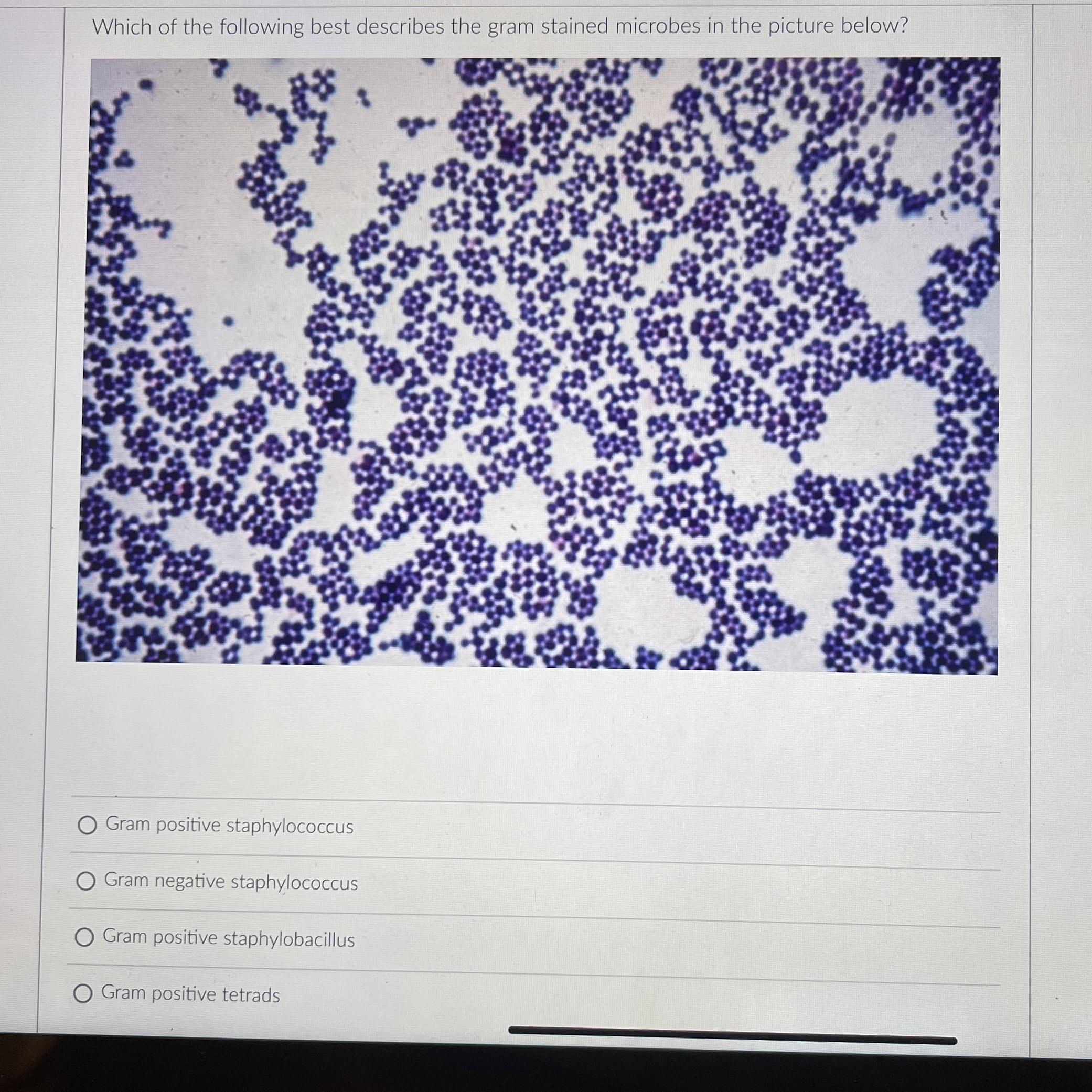 Solved Which of the following best describes the gram | Chegg.com