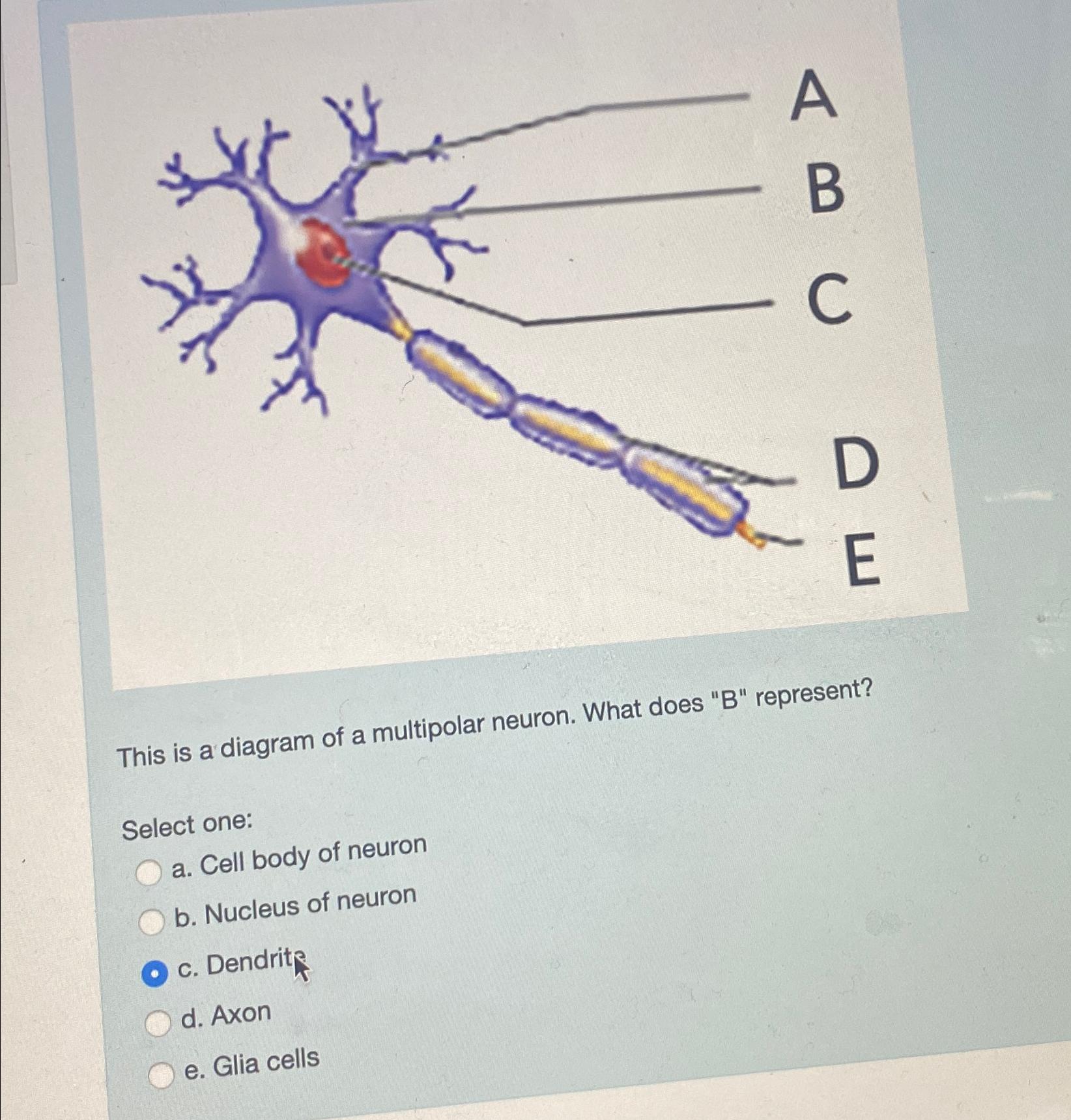 Solved This is a diagram of a multipolar neuron. What does | Chegg.com