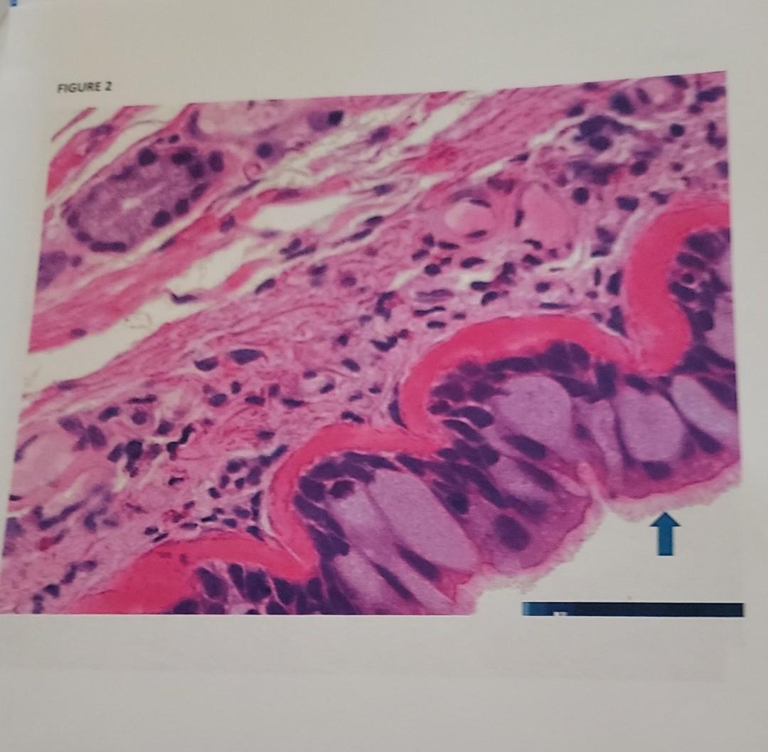Assignment 2, Unit 1 1. Name the four basic tissue | Chegg.com