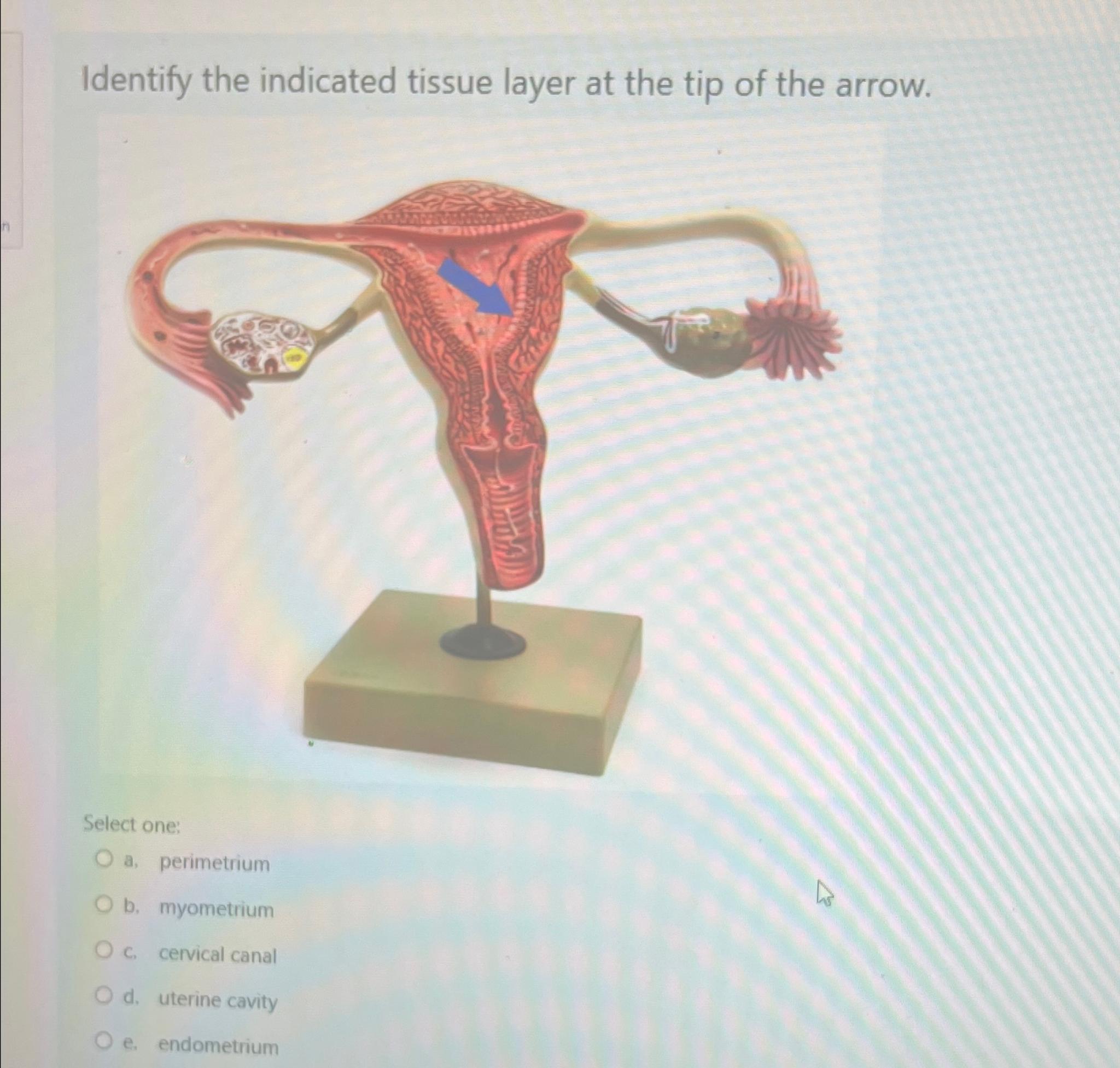 Solved Identify the indicated tissue layer at the tip of the | Chegg.com