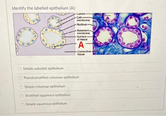 Solved Identify the labelled epithelium (A): Simple cuboidal | Chegg.com