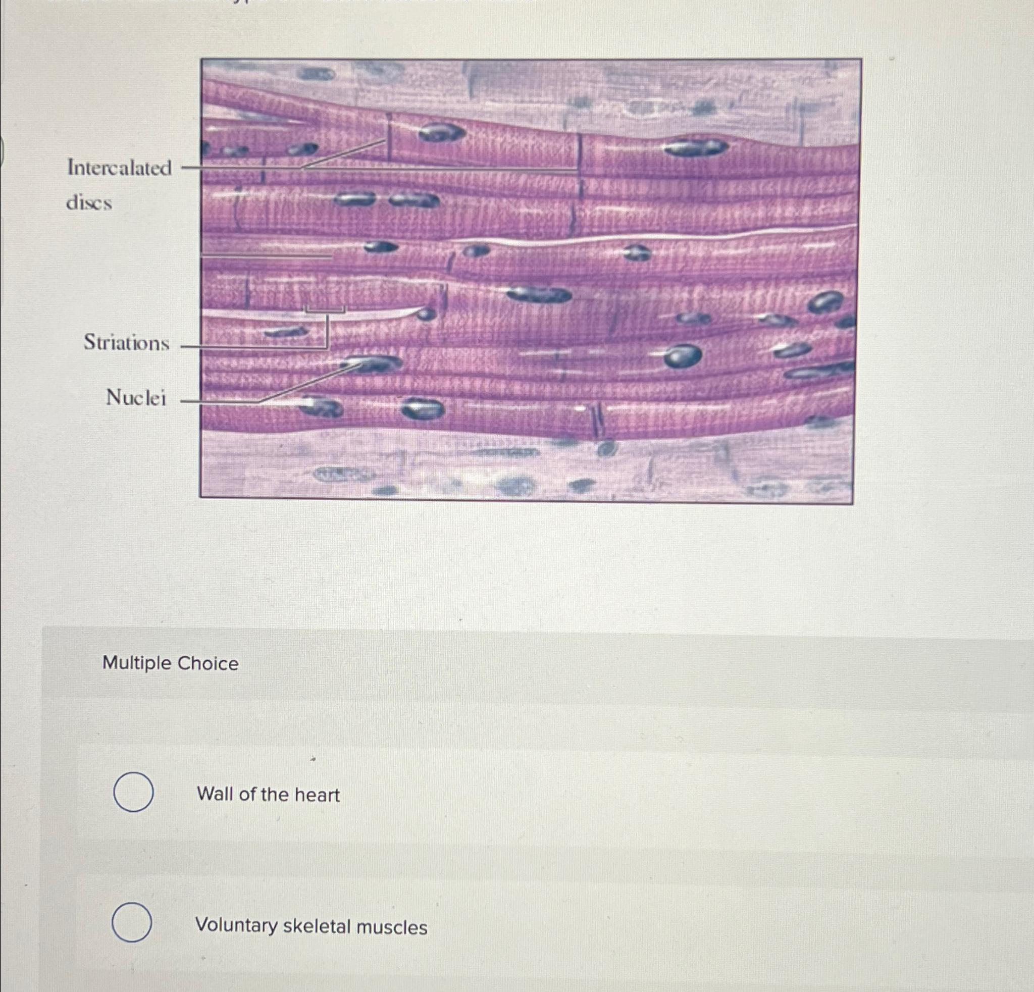 Solved Multiple ChoiceWall of the heartVoluntary skeletal | Chegg.com
