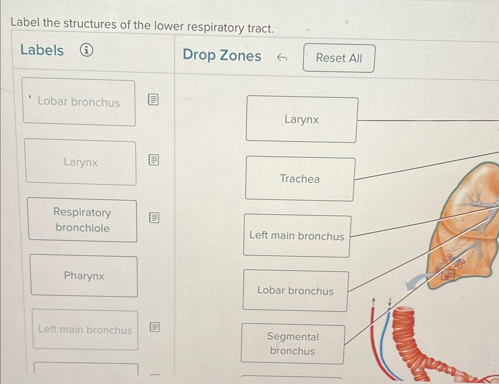 Solved Label the structures of the lower respiratory | Chegg.com