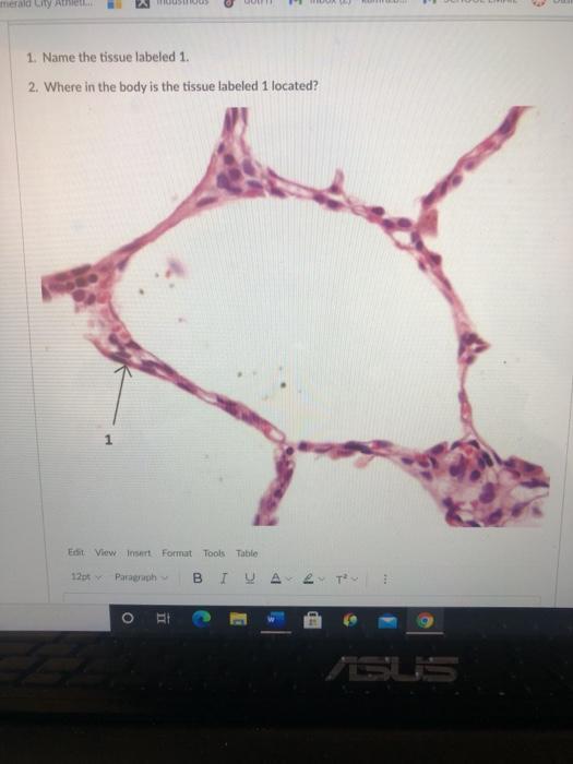 Solved merald City Alle 1. Name the tissue labeled 1. 2. | Chegg.com