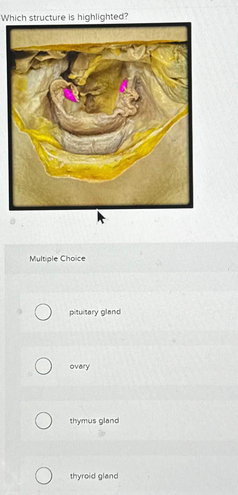 Solved Which structure is highlighted?Multiple | Chegg.com