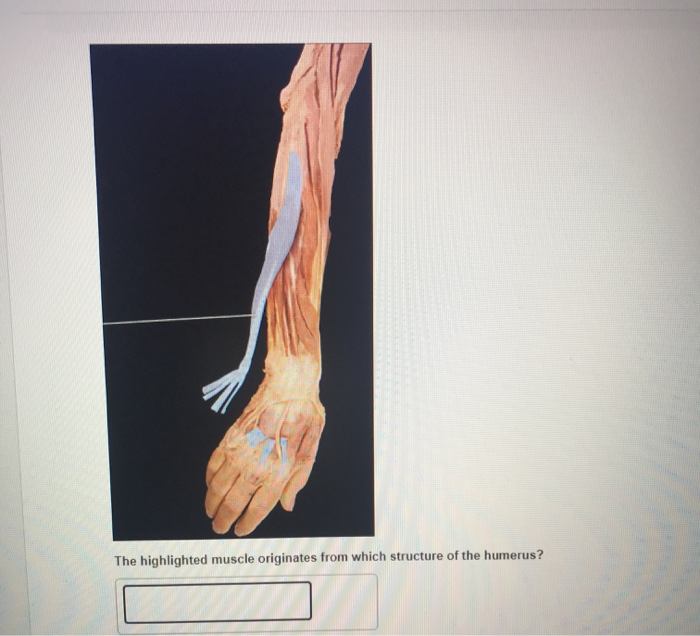 Solved The Highlighted Muscle Originates From Which Chegg solved-the-highlighted-muscle-originates-from-which-chegg