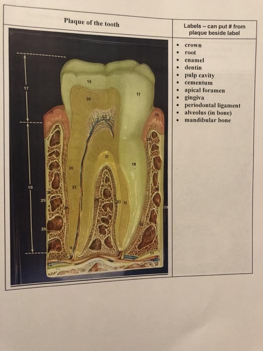 Solved Plaque of the tooth Labels - can put # from plaque | Chegg.com