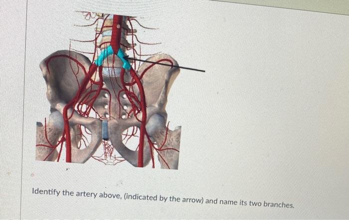 Solved Identify the artery above, (indicated by the arrow) | Chegg.com