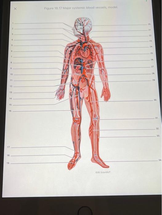 Figure 18:17 Major systemic blood vessels, model 20 2 | Chegg.com
