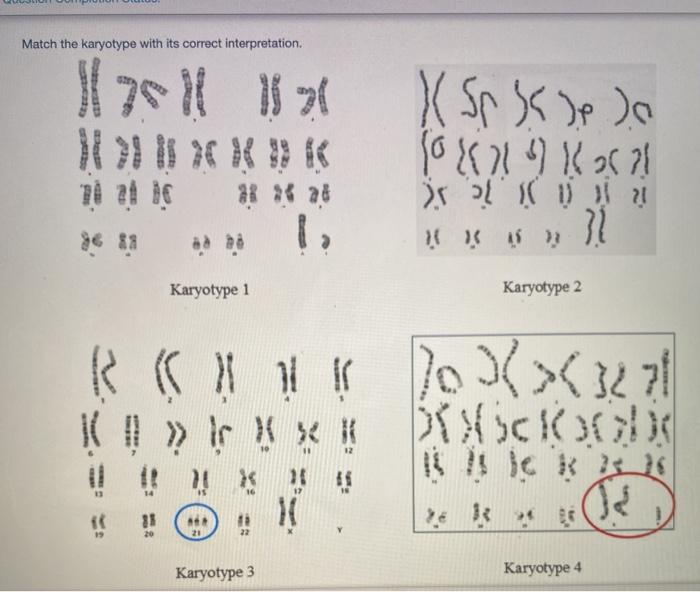 Solved Match the karyotype with its correct interpretation. | Chegg.com